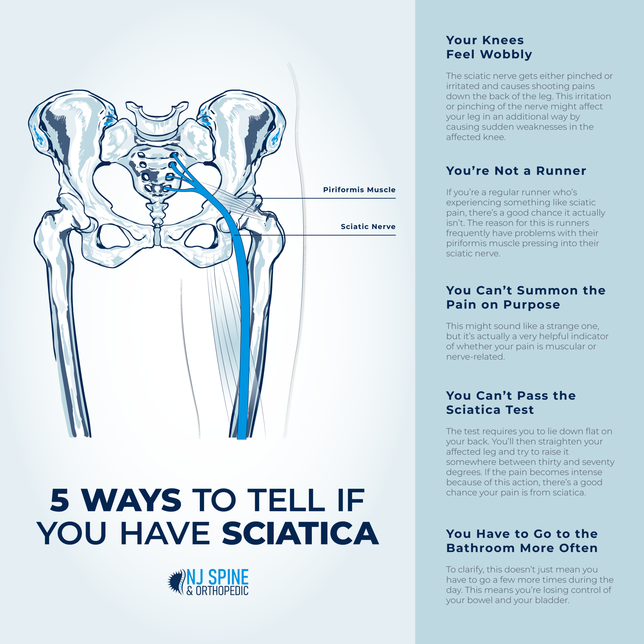 Five Ways to Diagnose Sciatica | How To Tell If You Have Sciatica