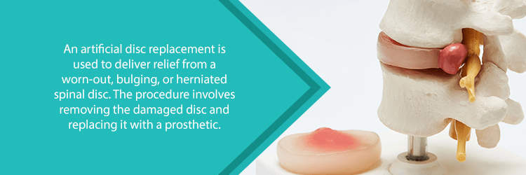 Artificial Disc Replacement: The Minimally Invasive Solution | NJSO