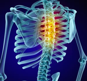 What Is a Medial Branch Block? | NJ Spine & Orthopedic